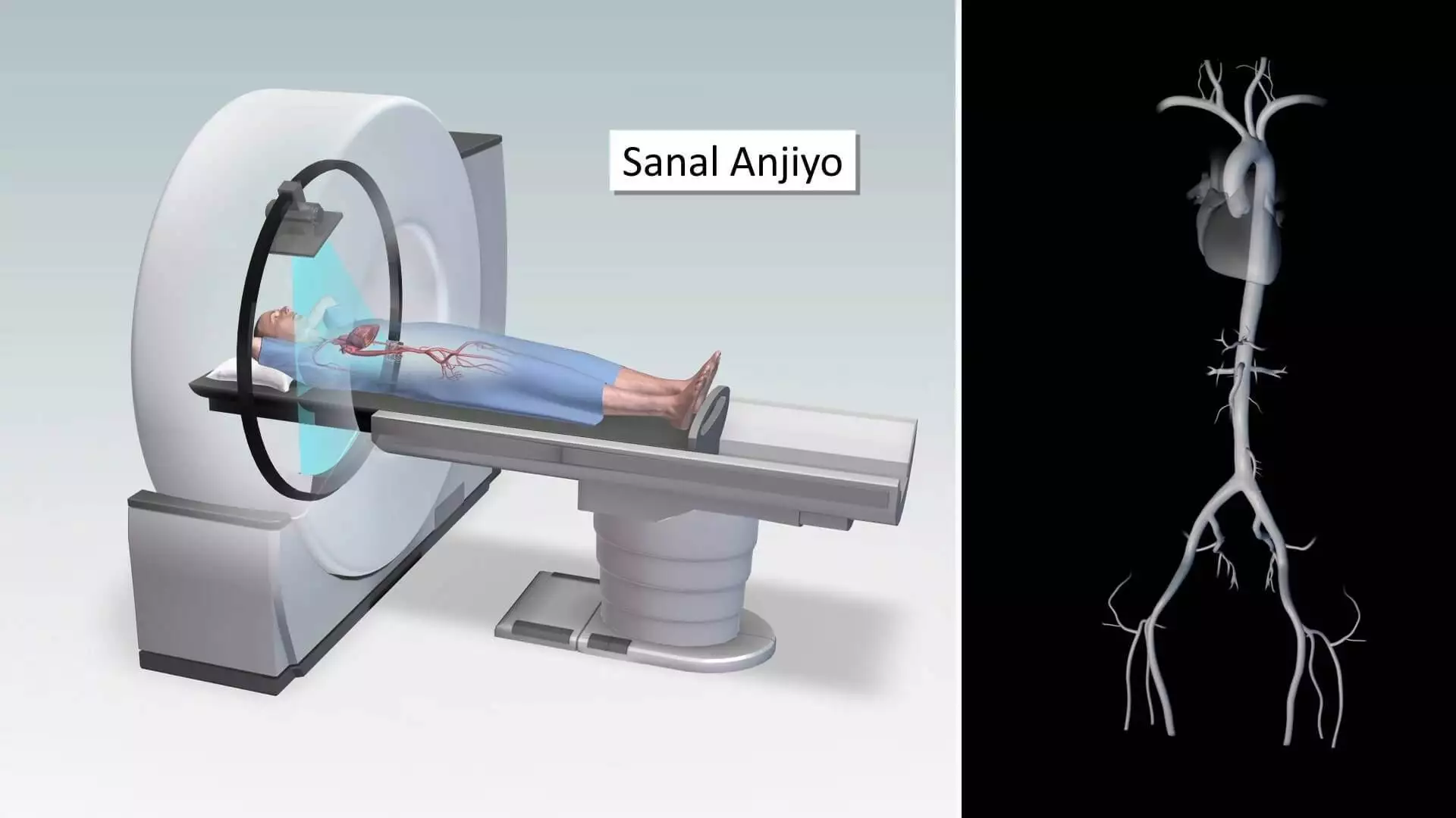 Sanal Anjiyo (BT Anjiyo) - Prof. Dr. Şükrü Akyüz - Girişimsel Kardiyolog