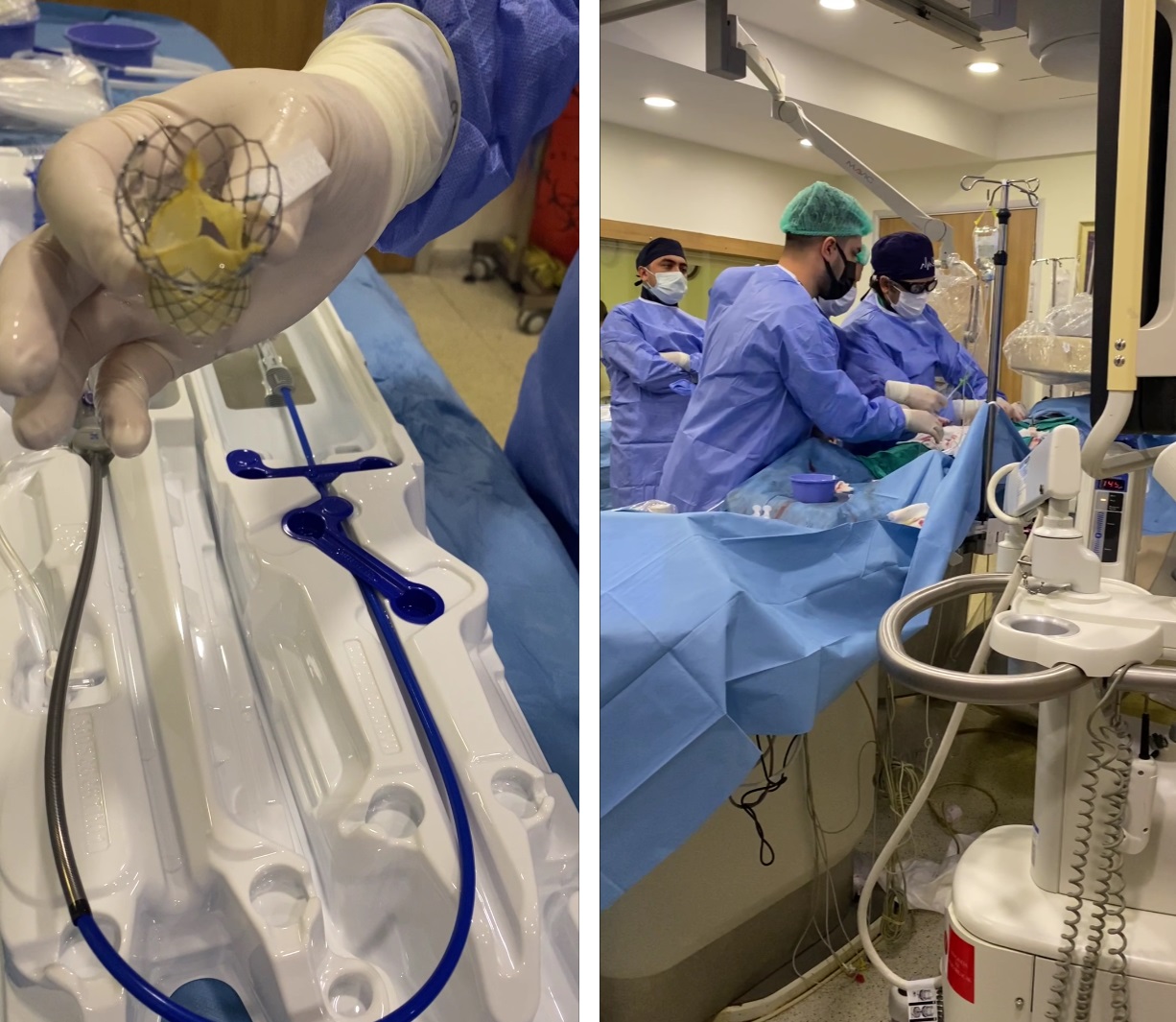 TAVİ Yöntemi - Prof. Dr. Şükrü Akyüz - Girişimsel Kardiyolog 2024